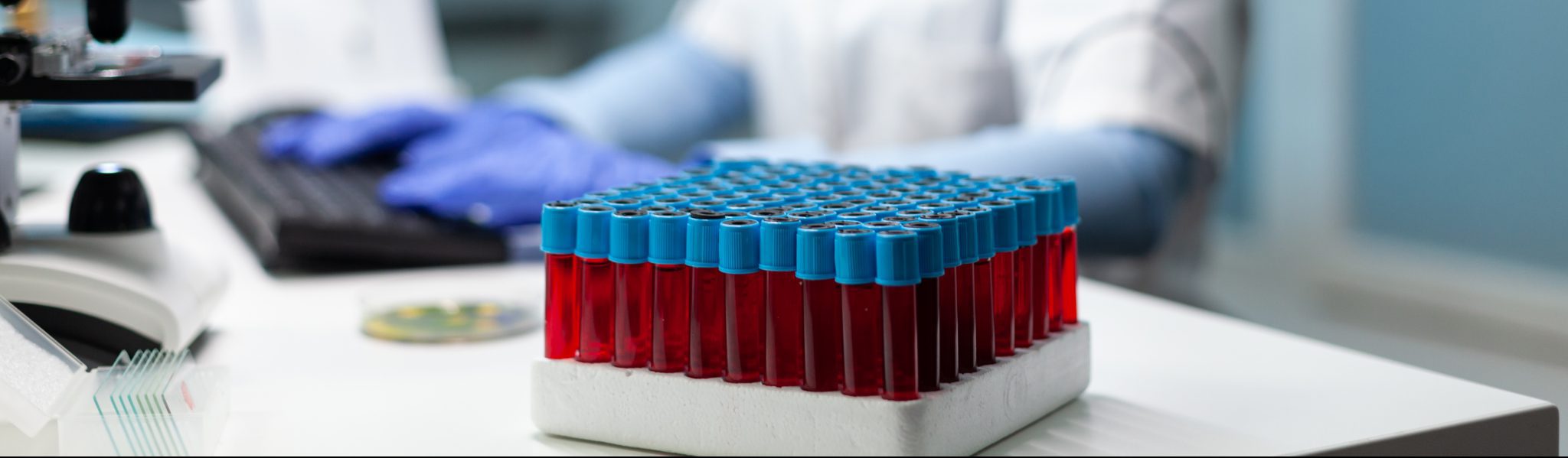 5 Reasons to Digitally Connect your Rack Scanner to LIMS